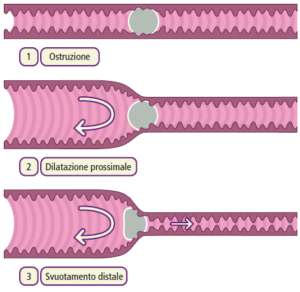 L’ileo meccanico e l’ileo paralitico in radiologia – Bald Mountain Science